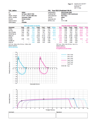 EasyOne Air Spirometer | MME